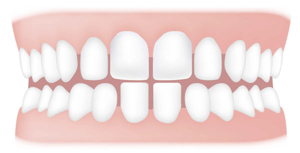 Malocclusion of the teethDr. Jacquie Monroe Ortho