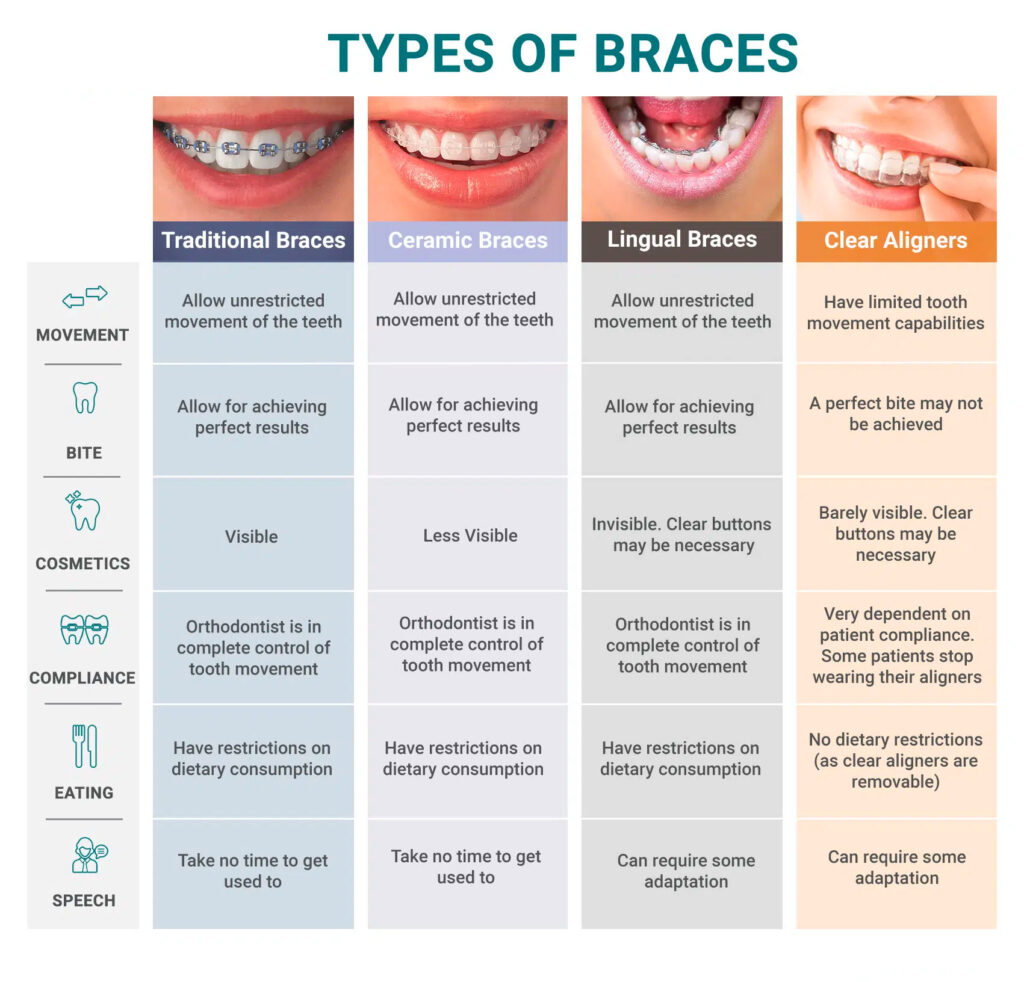 Types of Teeth BracesDr. Jacquie Monroe Ortho